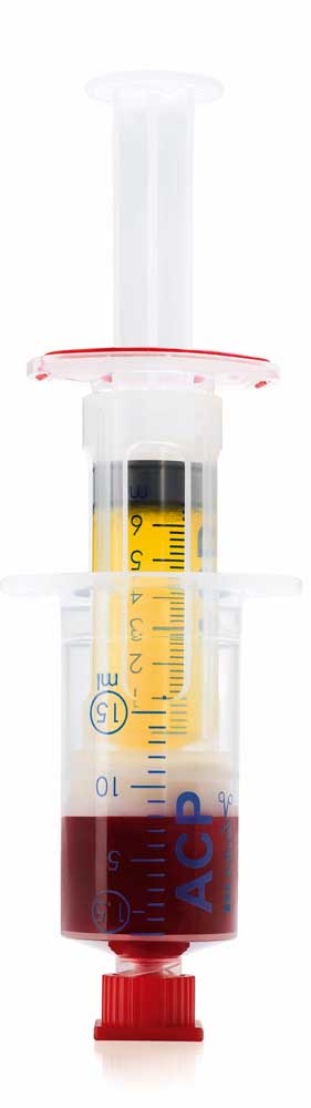 PRP-Therapie bei erektiler Dysfunktion | Uroclinic Augsburg - Uroclinic Augsburg